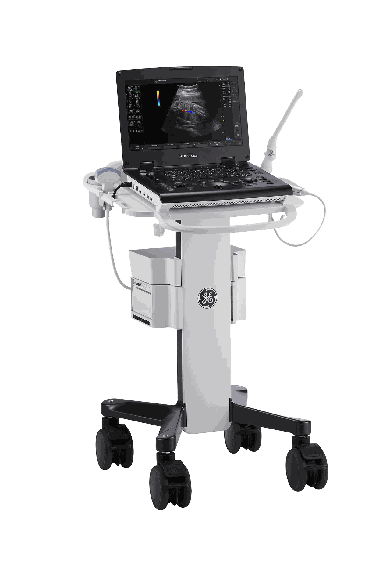 Ultrasonidos | Meyko