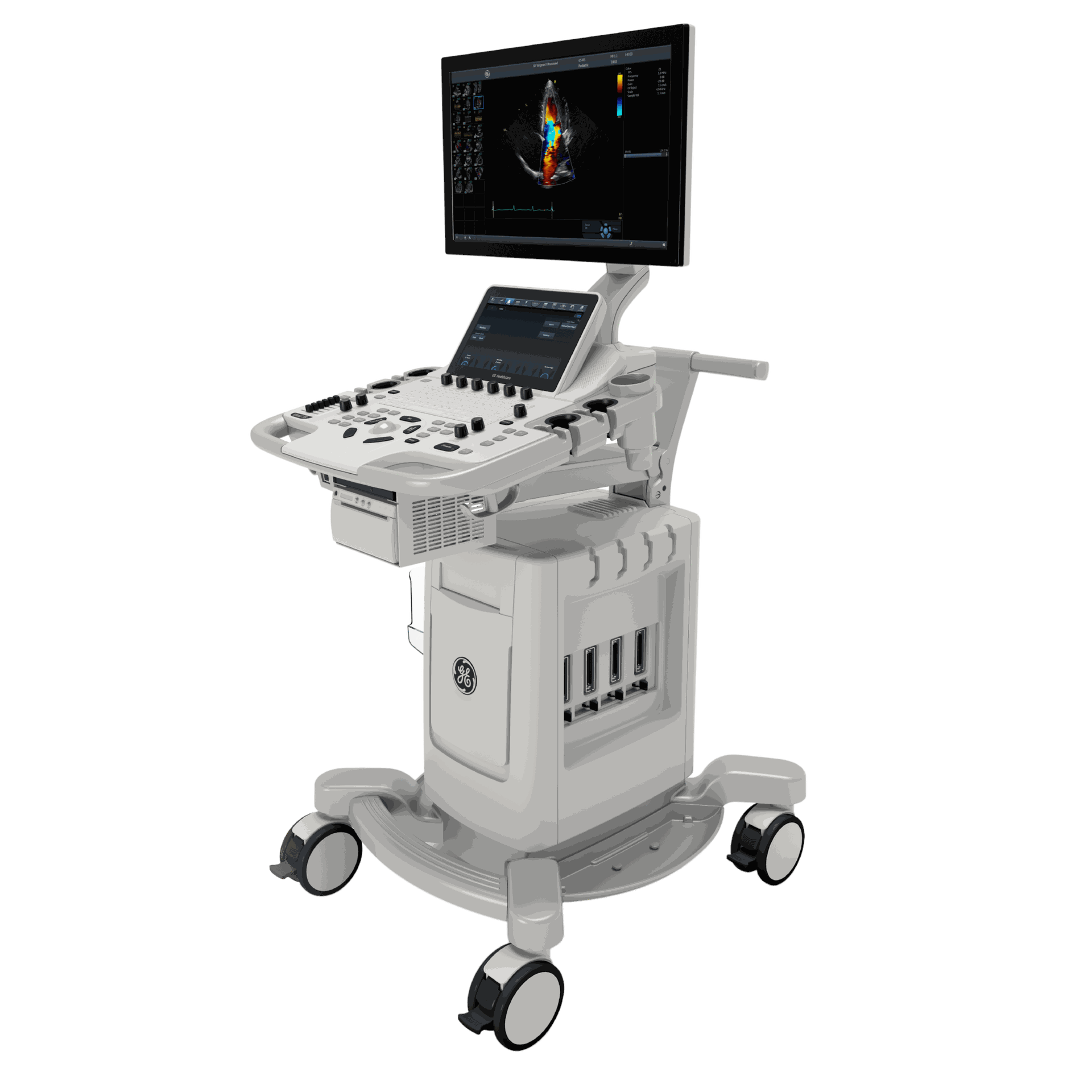 Ultrasonidos | Meyko